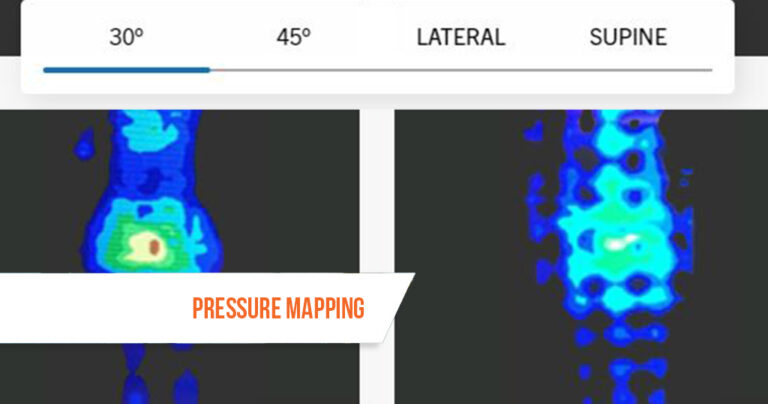Cushion Pressure Mapping Provides a Clear Vision | Clinical Resource | EHOB